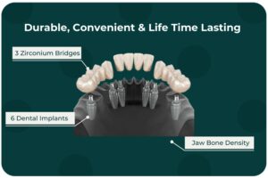 3 On 6 Dental Implant System - allondental.com